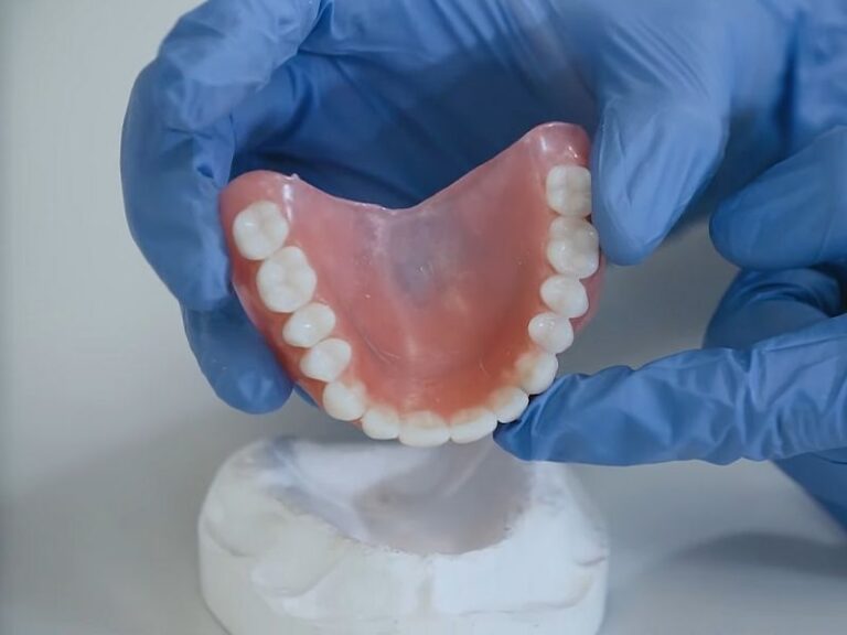 Veštački zubi - Cena, trajnost i održavanje - Zemdent